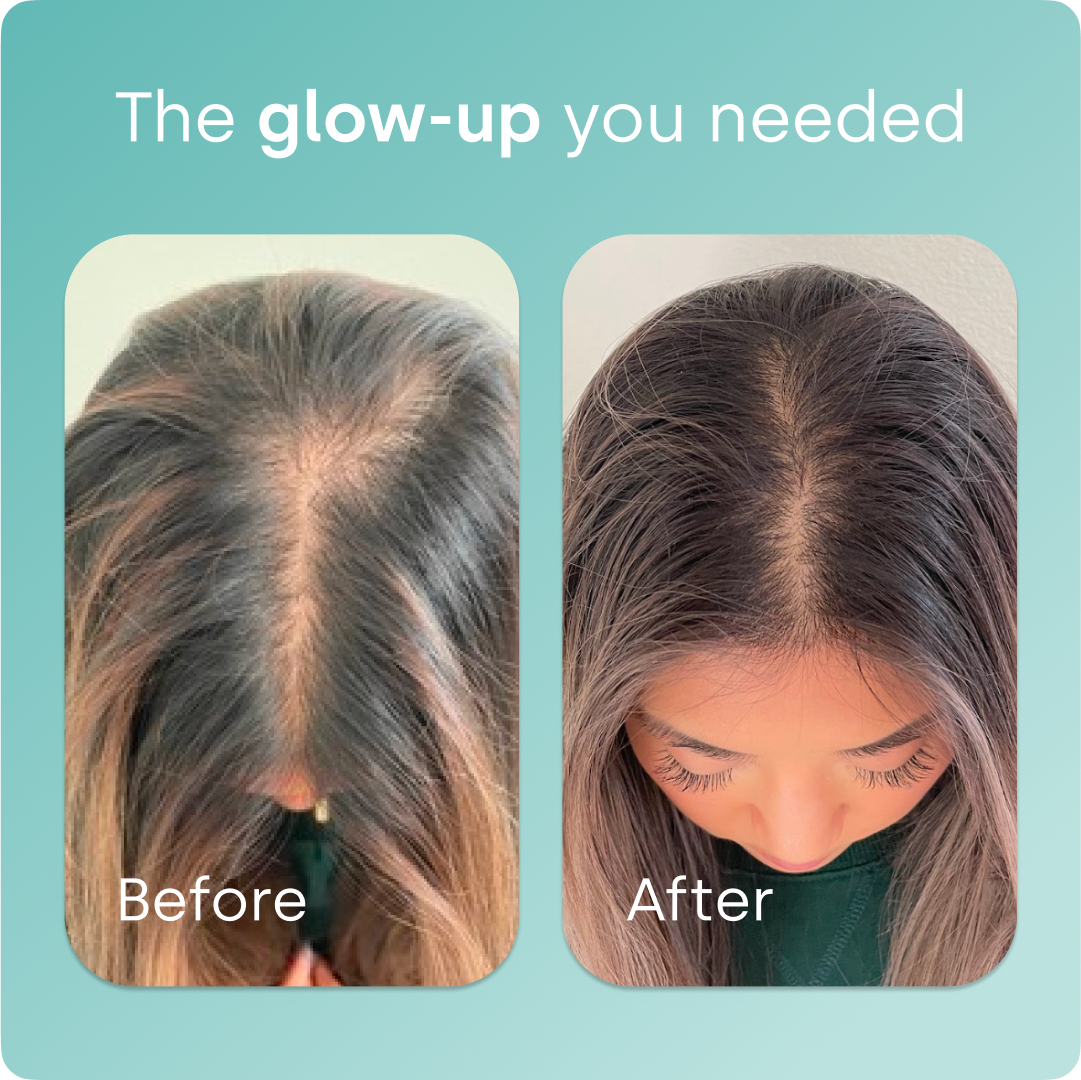 Collagen Generator - Original Capsules – Biosil Store